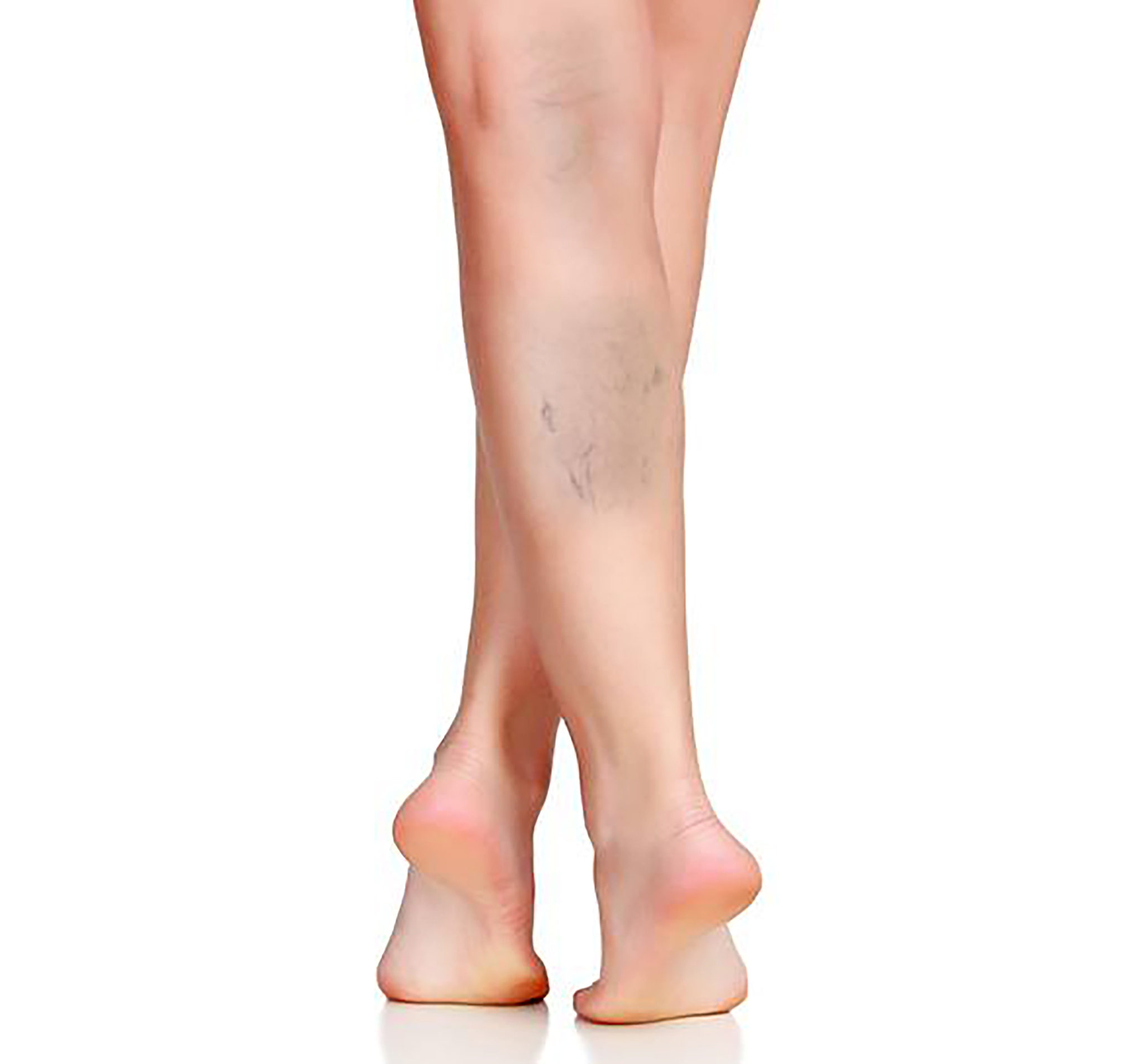 Varis, güzel bacakların en büyük düşmanı